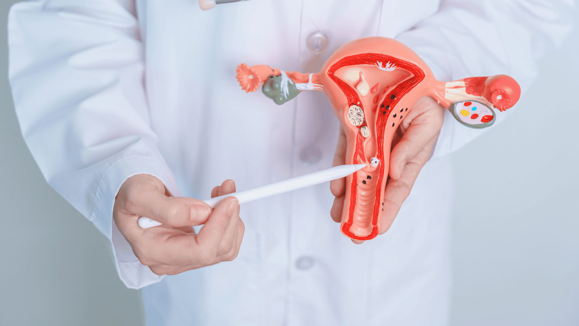 SurgeryBooking.com | Hysterectomy: Understanding the procedure and its ...